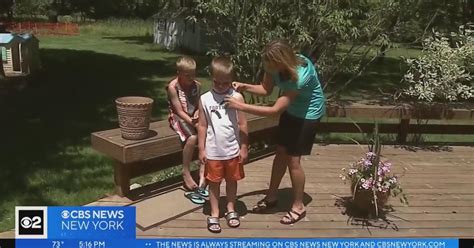 Tick Borne Diseases On The Rise On Long Island Cbs New York