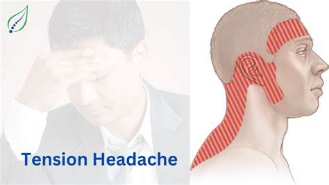 Conditions Best Back Pain Slip Disc Knee Arthritis Sciatica