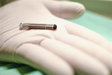 Il Loop Recorder — Luca Arioli