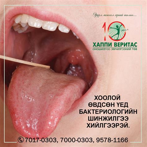 👉Бактериологийн шинжилгээ өгөхөд юуг анхаарах вэ⁉️ Бактериологийн