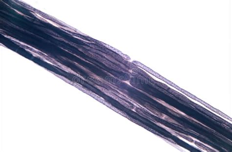 Myelinated Fibers Nodes Of Ranvier Stock Image Image Of Ranvier