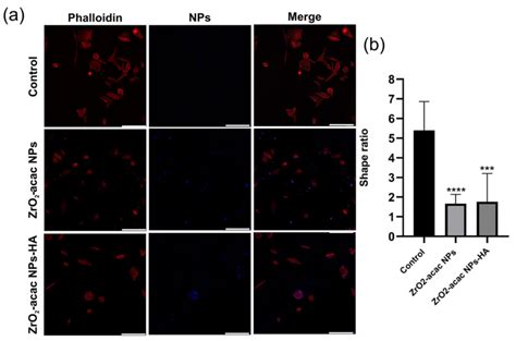 A Confocal Analysis Of Saos 2 Cells Red Incubated With Zro2 Acac