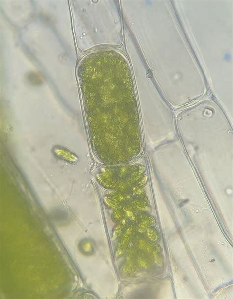 The Way These Algae Spores Are Released Rfeltgoodcomingout