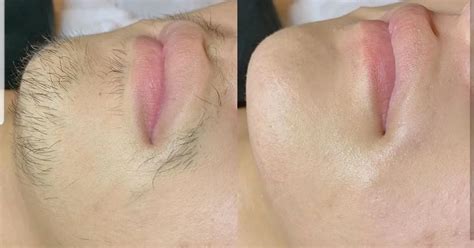 수염 왁싱 전 후 김나연 숨고 숨은고수