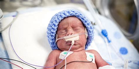 Preemies At Greater Risk For Mortality In Adulthood