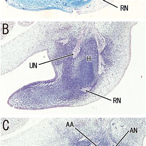 Horizontal Sections From An Embryo Of 15 Mm 6 Weeks He Staining