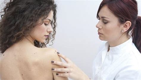 Como curar o herpes zóster passos
