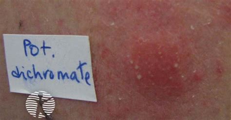 Patch Test Image