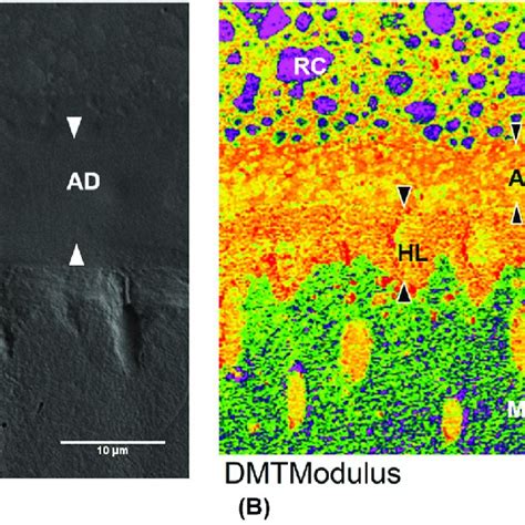 The Dmt Modulus Of The Adhesive Dentin Interface Was Analyzed By Afm Download Scientific