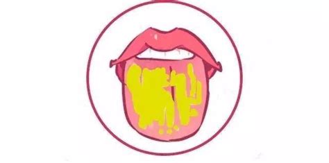 舌苔发黄、白厚、有裂纹，别大意！它是这些疾病的征兆 知乎