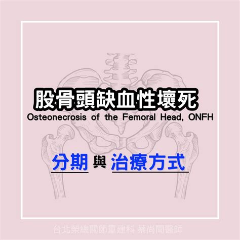 骨科線上 “股骨頭缺血性壞死，診斷分期與治療方式” 髖關節附近好痛😥 我們怎麼知道是不是股骨頭缺血性壞死呢？