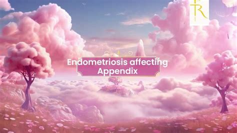 Robotic Approach Endometriosis Involving The Appendix Tanushree Rao