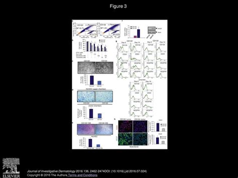 Notch1 Mapk Signaling Axis Regulates Cd133 Cancer Stem Cell Mediated