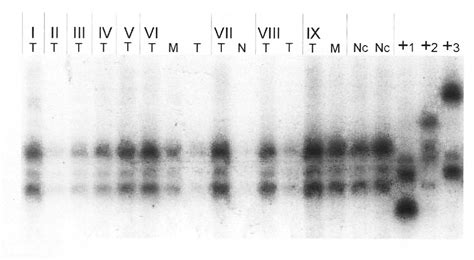 Figure 1 From Absence Of Activating Mutations In Ras And Gsp Oncogenes