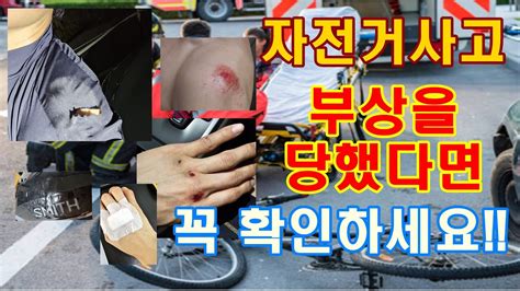 자전거 사고로 부상을 당한 경우 꼭 확인해 보세요 Youtube