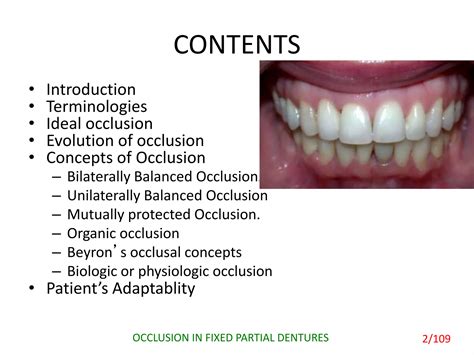 Occlusion In Fixed Partial Denture Pptx Dental Health Diseases And Conditions