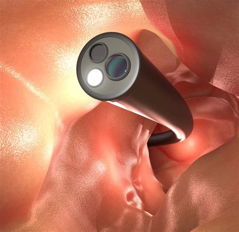 High Resolution Esophageal Manometry Valiant Clinic