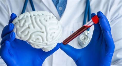 Fatal Familial Insomnia Symptoms Causes Life Expectancy