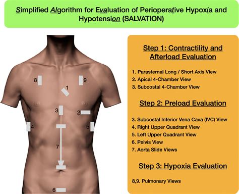 Simplified Algorithm For Evaluation Of Perioperative Hypoxia And Hypotension Salvation A