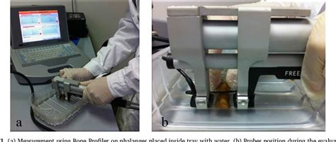Figure 1 From Quantitative Ultrasonometry For The Diagnosis Of