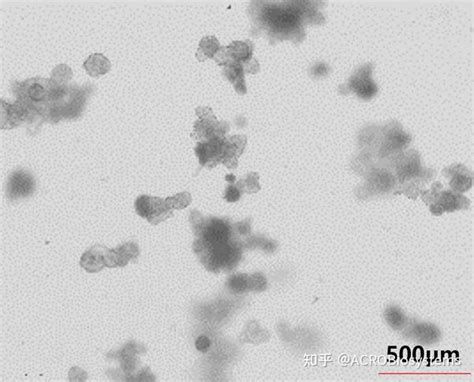 Wnt 3a Noggin Egf Rspo1 类器官培养体系“四巨头” 知乎