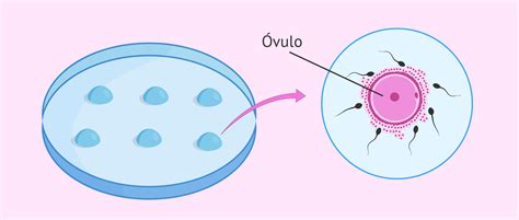 ¿cuáles Son Las Tasas De éxito De La Fecundación In Vitro Fiv
