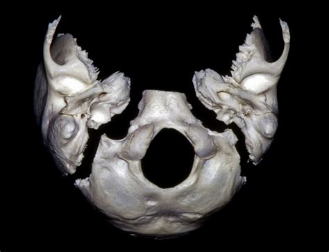 Inferior View Of Disarticulated Temporal And Occipital Bones