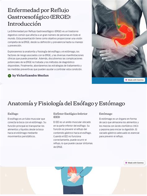 Guía Completa Sobre La Erge Pdf La Enfermedad Por Reflujo