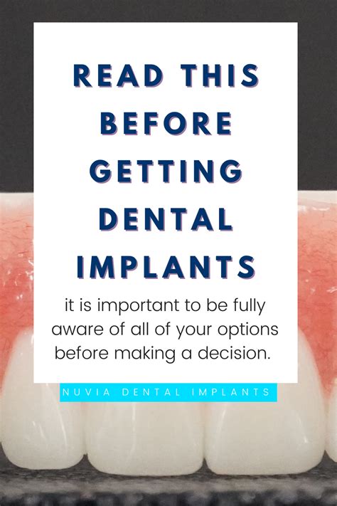 5 Things You Need To Know About Dental Implants A Comprehensive Guide