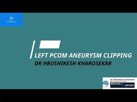 Hrushikesh Kharosekar On Linkedin Left Pcom Aneurysm Clipping