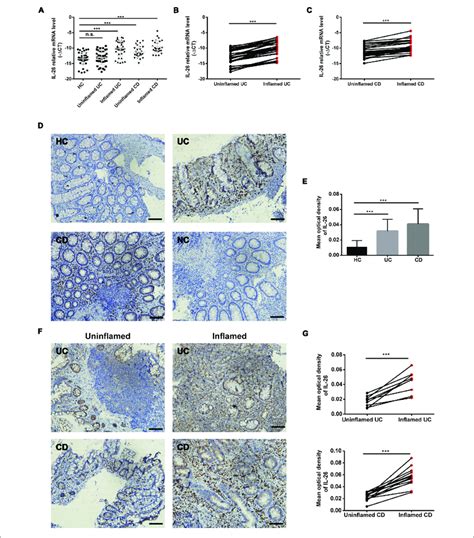 Il 26 Expression Is Increased In The Inflamed Intestinal Mucosa Of