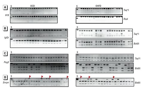 Dna Methylation Patterns In Dmrs Of Paternally Imprinted Gene H19 A