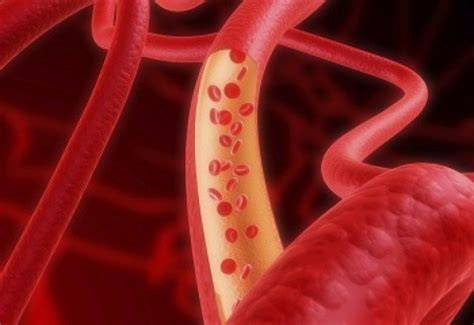 Внутреннее кровотечение признаки причины симптомы лечение и профилактика Idoctor Kz