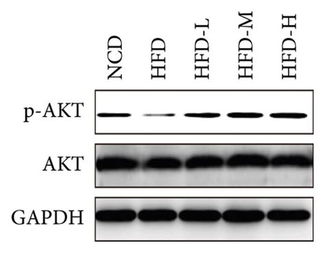 HTE Activates Signalling Pathways Controlling Lipid And Glucose