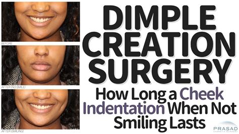 Dimple Creation Surgery How Long Cheek Indentation When Not Smiling