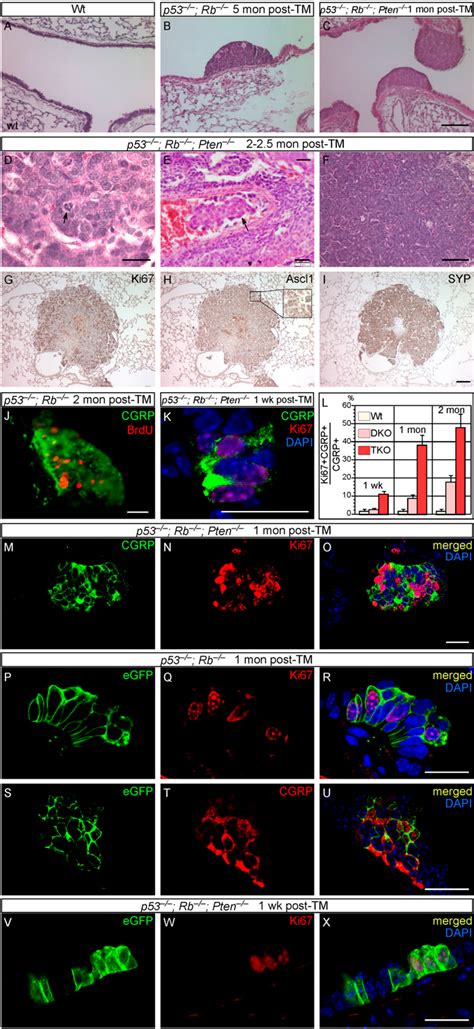 Figure 4 From Functional Characterization Of Pulmonary Neuroendocrine