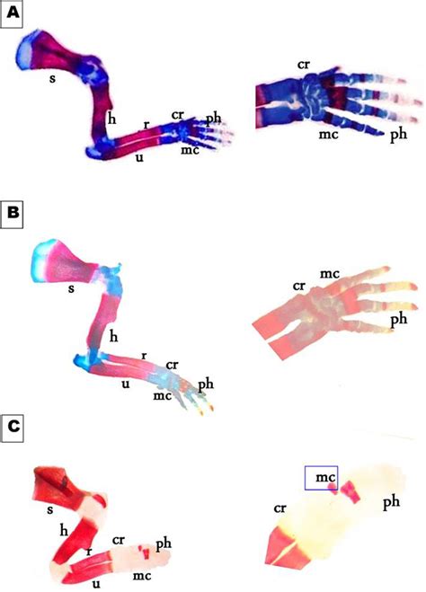 Photomicrographs Of A Lateral View Of The Scapula And Fore Limb Of The Download Scientific