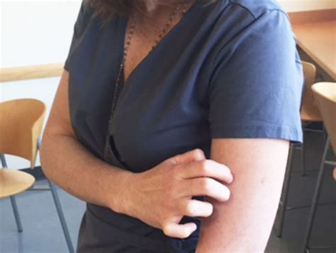 Skin Cysts And Cancerous Growths What Is The Difference