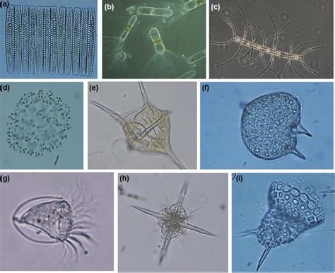 Microscopic Pictures Of Southern Ocean Protists The Diatoms