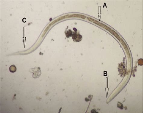 Picture Of Infective Larva L 3 Of Trichostrongylus Spp Download Scientific Diagram