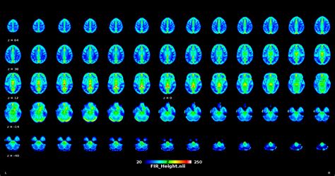GitHub Bids Apps RsHRF Resting State HRF Estimation From BOLD FMRI Signal