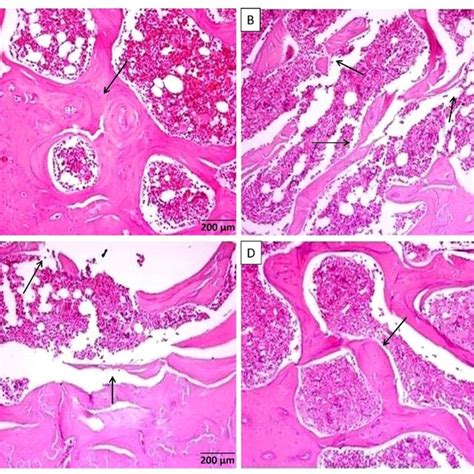 A Rat Femur Sections From Control Group I Showed Benign Looking Bone Download Scientific
