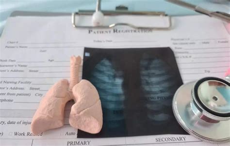 Anatomic Lung Resection Linked To Improved Survival For Early Stage Lung… Ethealthworld