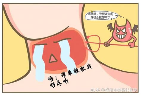 一不小心睡落枕了怎么办，别慌！这三招教您拯救您的颈椎 知乎