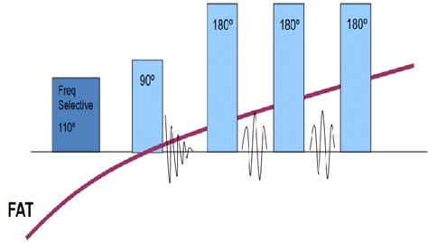 Diagram Of SPIR Philips Download Scientific Diagram