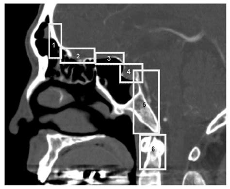 Schematic Depiction Of The Sagittal Plane Module On A Download