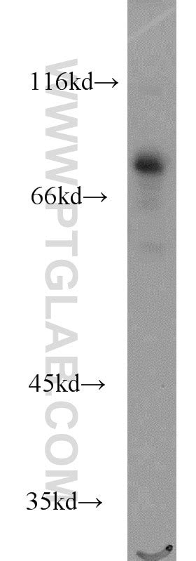 Runx1t1 Antibody 15494 1 Ap Proteintech