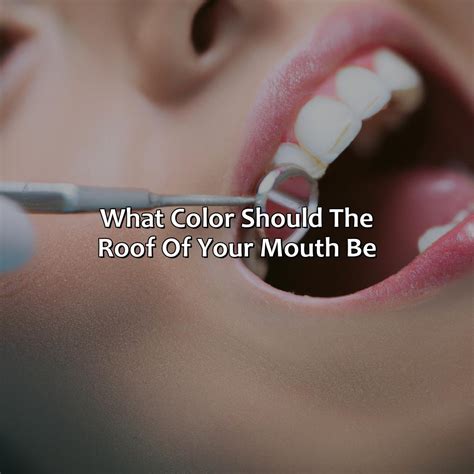 What Color Should The Roof Of Your Mouth Be