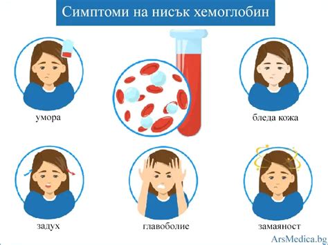 Симптоми на нисък хемоглобин Arsmedica Bg