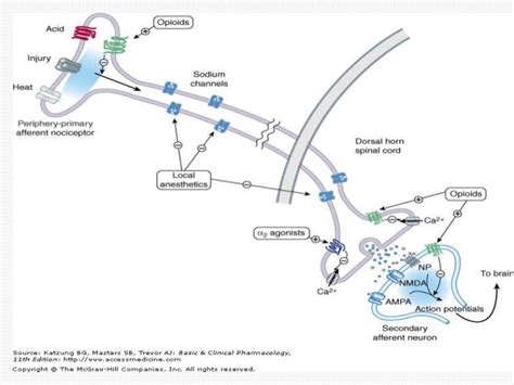 Systemic Lidocaine Infusion